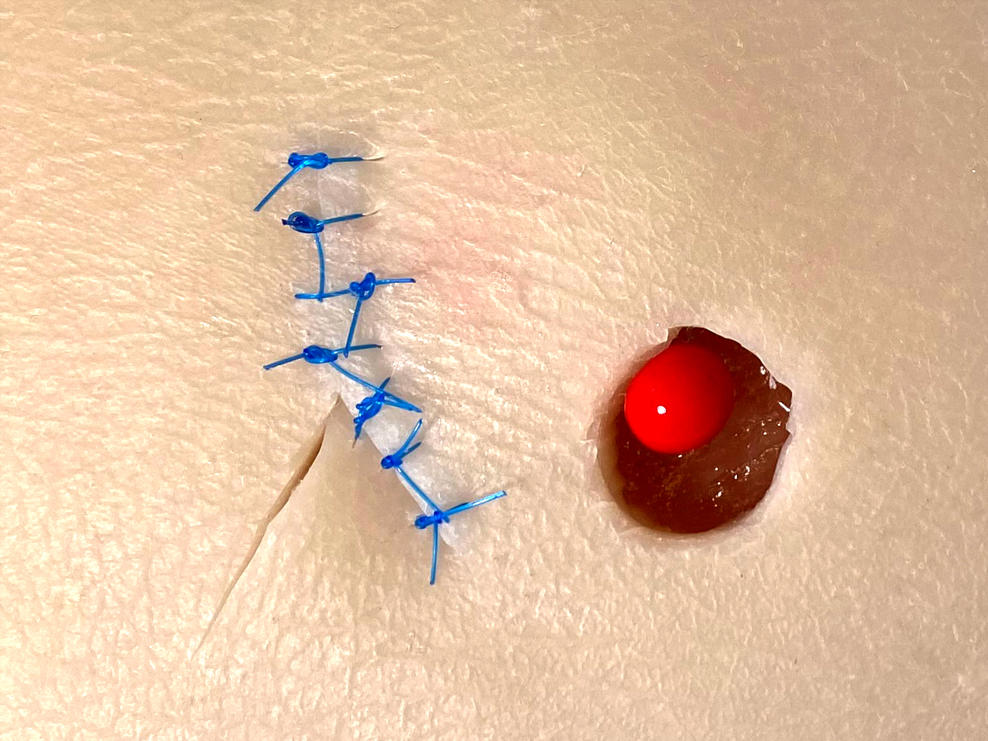 Placa piel suturas y lesiones cutáneas variedades – Simularte